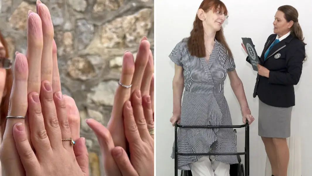 Longest finger on a living person (female) | Guinness World Records