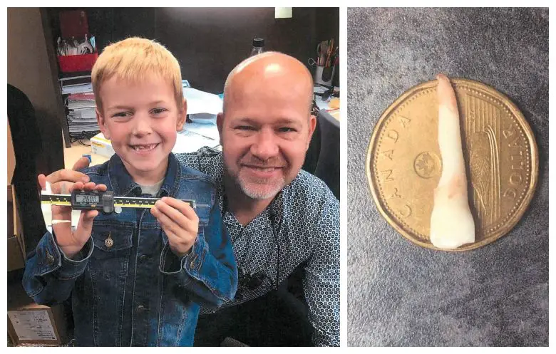 Longest milk tooth extracted | Guinness World Records